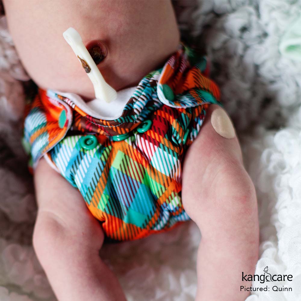 Lil Joey All In One Cloth Diaper (2 pk) - Honey Yellow | Kanga Care